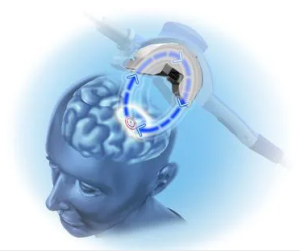 TMS Treatment - Principium Psychiatry | NYC-Greenwich-Santa Monica, CA